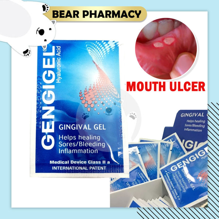 GENGIGEL Sachet 1ml 1 Pack/ 5 Packs [Exp: 05/2025] Gingivitis, Gingival ...
