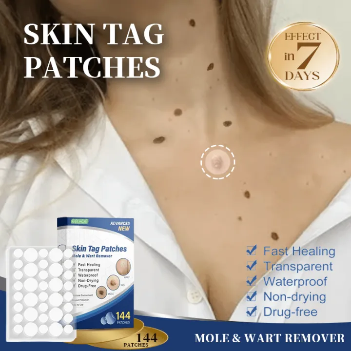 Eelhoe Skin Tags Moles Remover Patches Pimple Wart Treatment Herbal ...