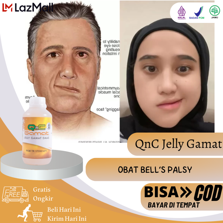obat herbal bels palsy asli, obat bells palsy, obat saraf bell palsy, obat saraf wajah lumpuh ...