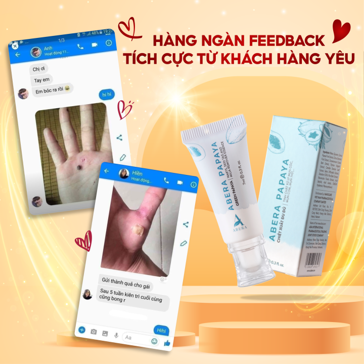 Gel tẩy mụn cóc ở tay chân dứt điểm Abera Papaya 7ml, từ 10 - 14 ngày ...