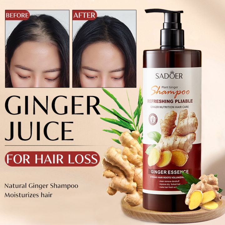 Ginger Scalp Treatment Anti-Hair Loss Shampoo Natural Ginger Extract ...