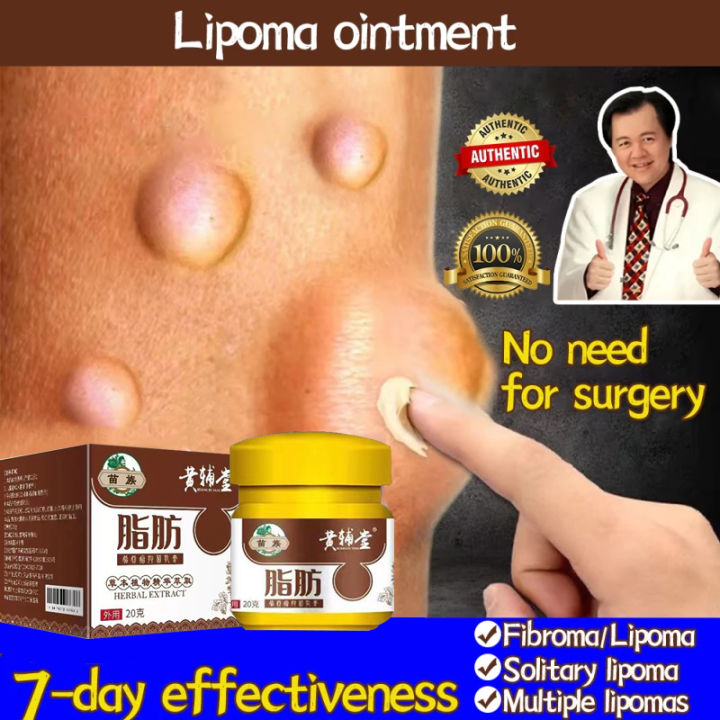 Lipoma Removal Cream 20g Lipolysis Fat Lump Relieve Plaster Skin ...