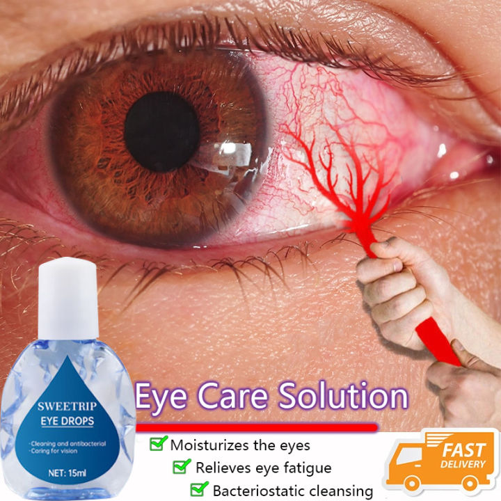 SWEETRIP Eye Drops Relieve Ophthalmic Liquid Itchy Eye Swelling Sore ...