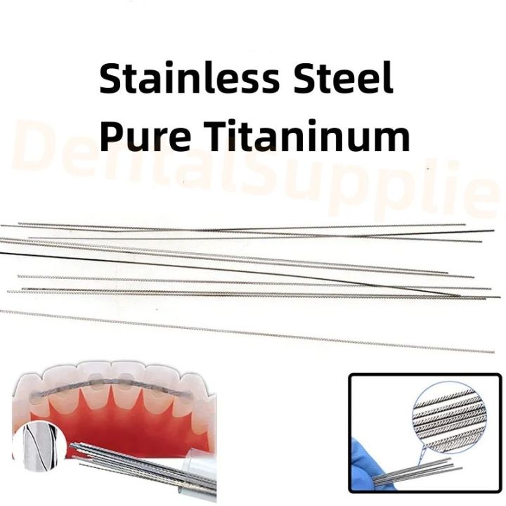 Orthodontic Lingual Retainer Wire at Dorothy Holcomb blog