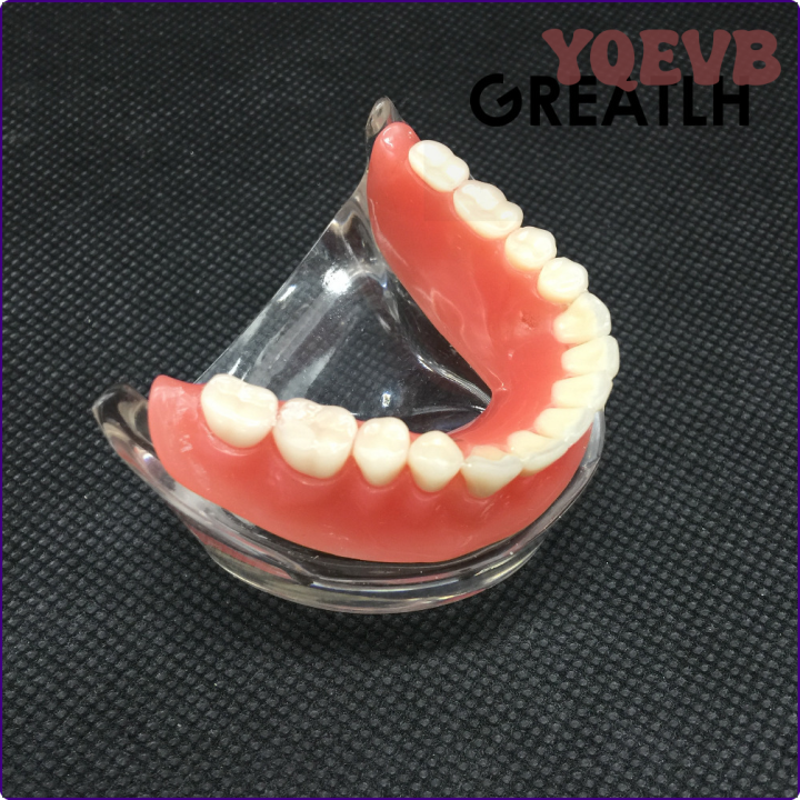 YQEVB Dental Overdenture Interior Mandibular Lower Teeth Model ...