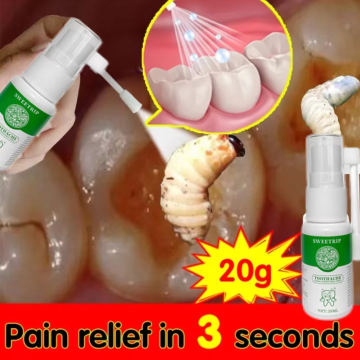 SWEETRIP Toothache Spray Instant Teeth Pain Fast Pain Relief Treatment ...