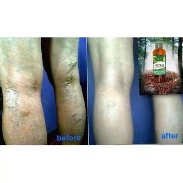 HAPLAS WONDER LINIMENT OIL | Lazada PH