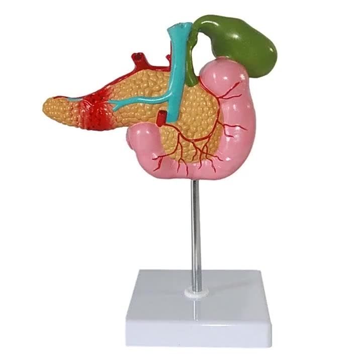 Life Size 1:1 Human Pancreas Duodenum Gallbladder Pathological ...