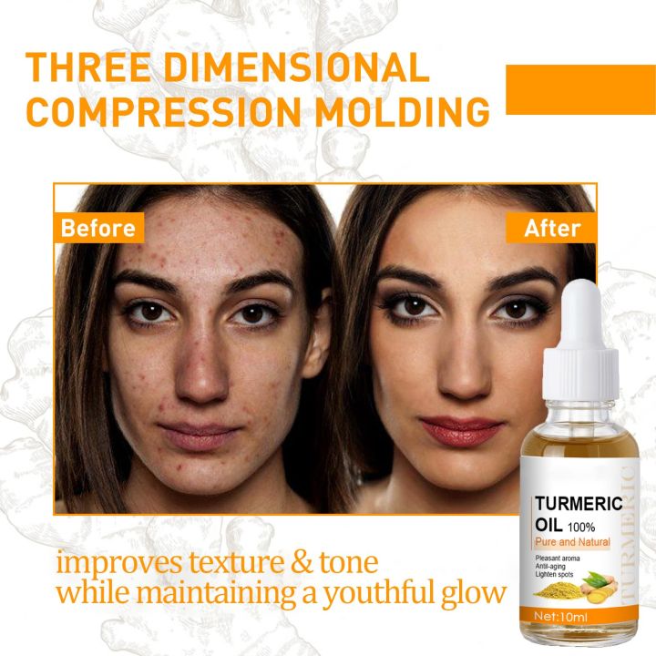 Turmeric Oil Face Whitening Lightening Acne Dark Patches Anti-aging ...