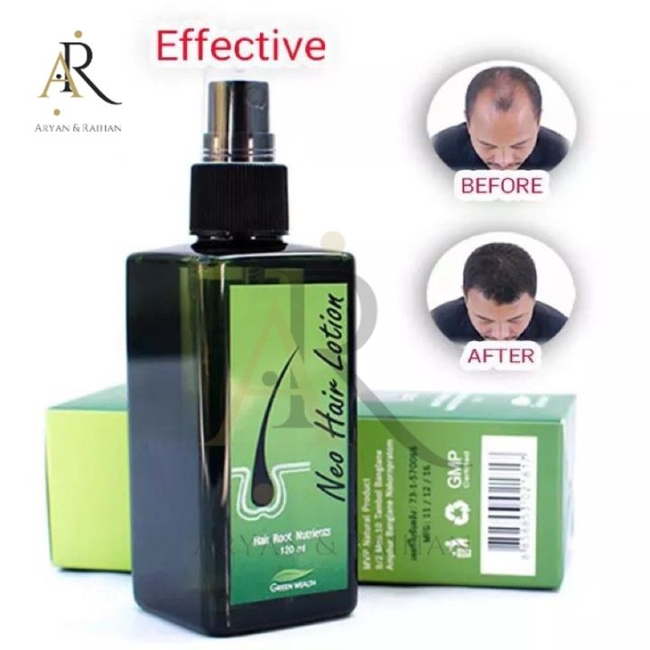 NEO HAIR LOTION New FORMULA of Hair Transplant and Hair Loss Treatment ...