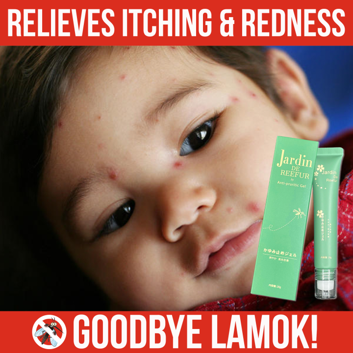 Relieve Itching Gel, Authentic Jardin De Reefur Anti Pruritic Cream 20g ...