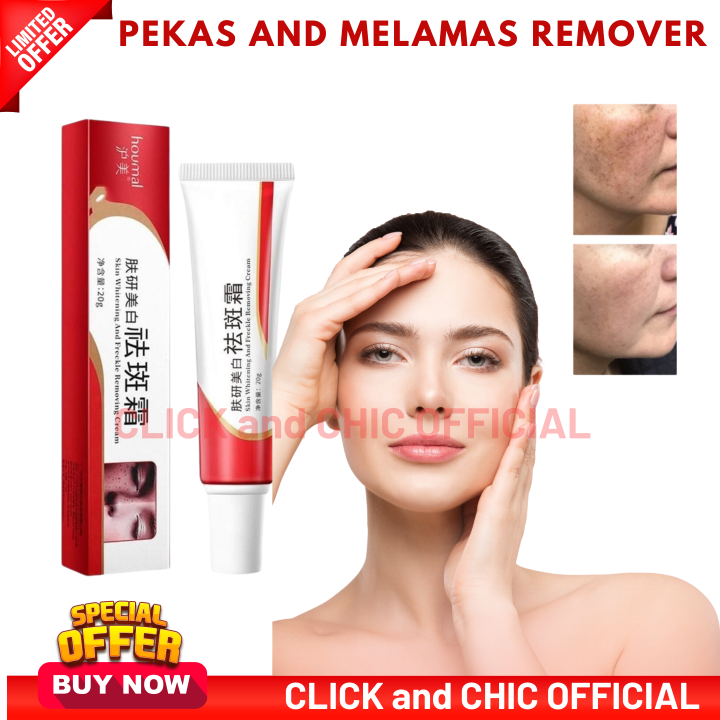 CLICK and CHICK Original Melasma Remover Cream - Effective Pekas and ...