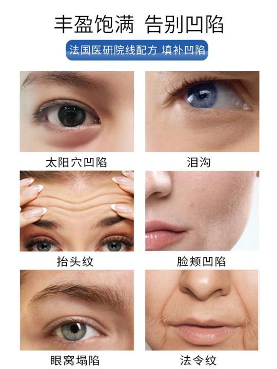 "SF Express" Feng Temple forehead is full, tear groove is removed, eye ...