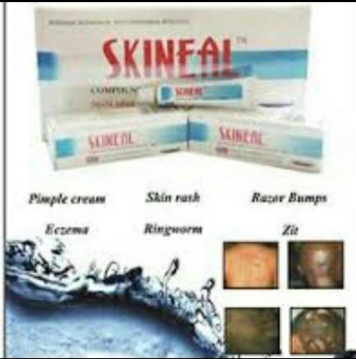 SKINEAL ANTI-FUNGAL CREAM | Lazada PH