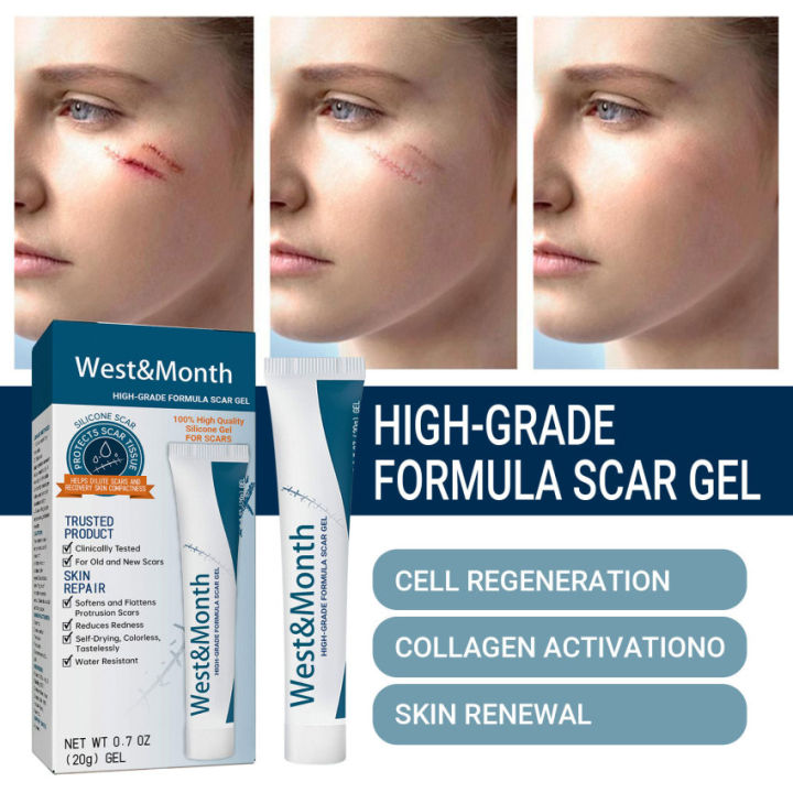 West&Month Herbal Scar Removal Cream Gel For Pock Mark Burn Sur-gical ...