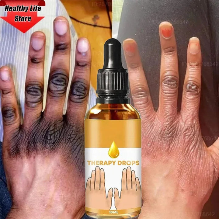 Dark Knuckles Fast Brighten Serum Elbows Hand Knuckle Brightening Serum ...