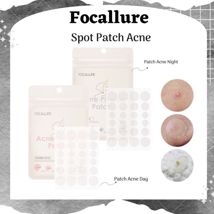 Focallure Spot Acne Patch Treatment Day/Night Waterproof Smooth ...