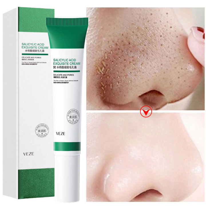 Salicylic Acid Pores Refining Cream Shrink Pore Improve Acne Blackheads