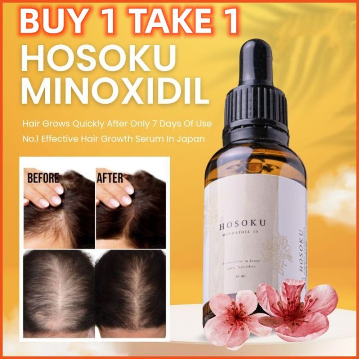 HOSOKU MINOXIDIL 15% ORIGINAL Hair Growth With Collagen And Castor Oil ...