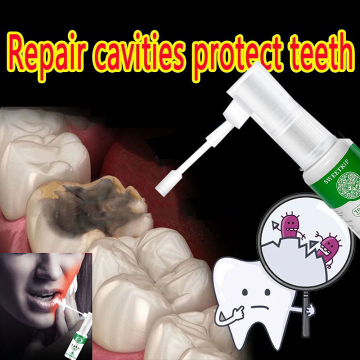 SWEETRIP Toothache Pain Reliever Spray Instant Teeth Pain Treatment ...