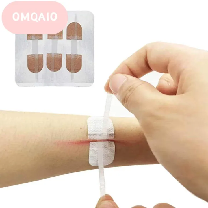 OMQAIO 3pcs/set Without Stitches Zipper Wound Closure Patches ...