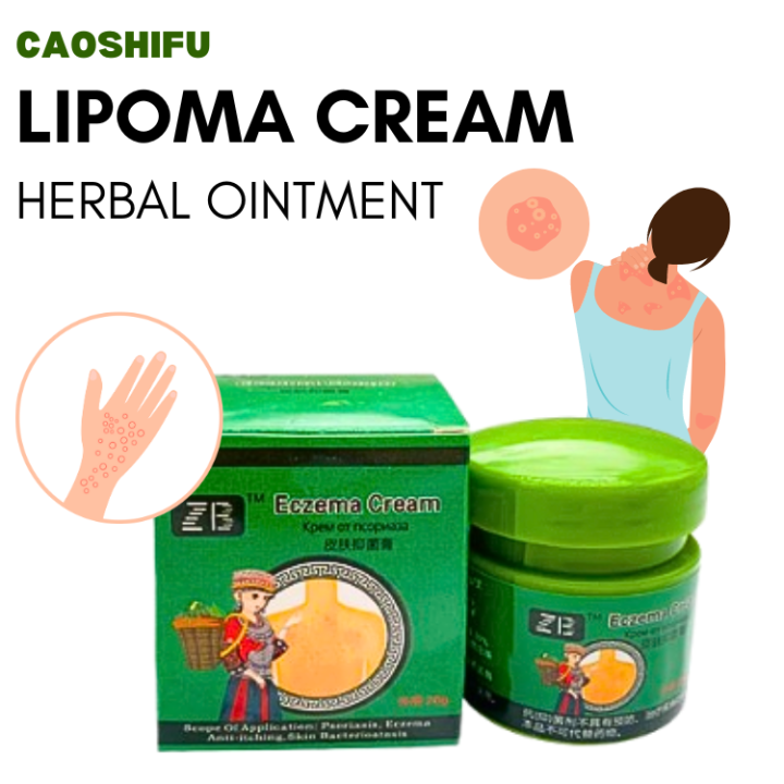 Zb Eczema Treatment Cream 20g Eczema Cream Psoriasis Treatment Cream