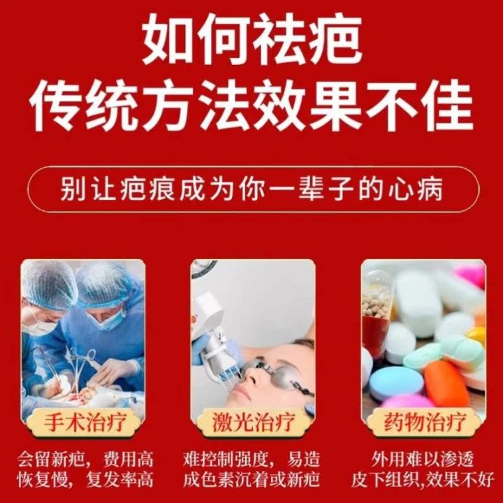 Scar repair medicine scar burn scar surgery suture scar scar ...