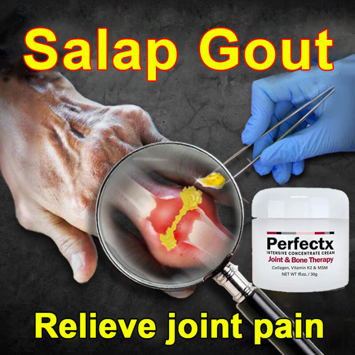 perfectx jointment cream arthritis pain relief gout ointment bunion ...