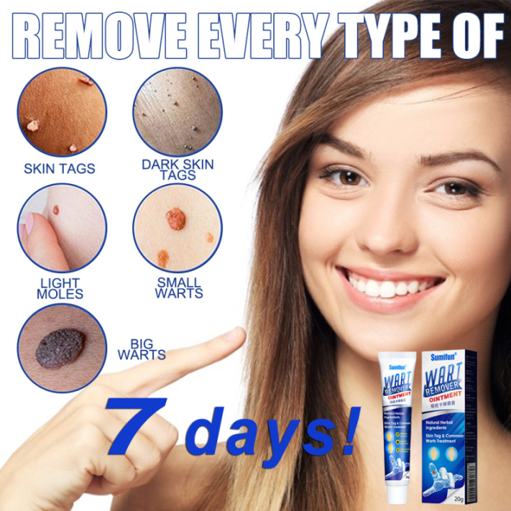 100% Effective Verruca Removing Agent Original Verruca Removing Magic ...