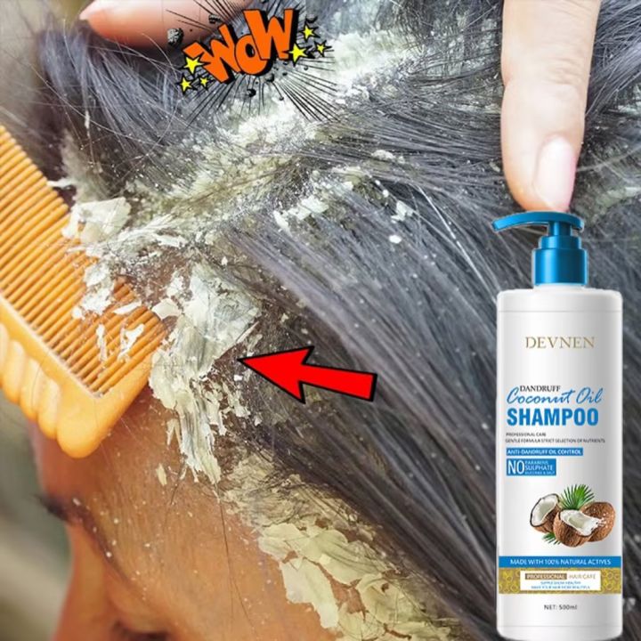 DEVNEN Coconut Oil Shampoo 500ML Anti-Dandruff Repair Damage Relieve Itching Moisturizing Hair ...