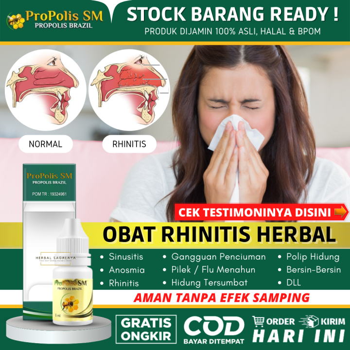 Obat Rhinitis Alami 100% ASLI - Obat Penyakit Rhinitis Tradisional ...