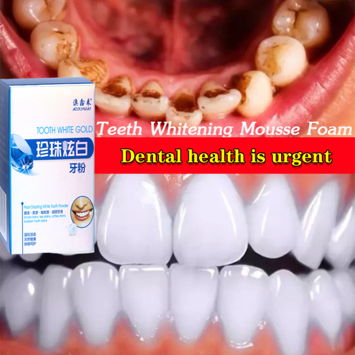 Teeth whitening yellow smoke stains calculus tooth powder cleaning ...