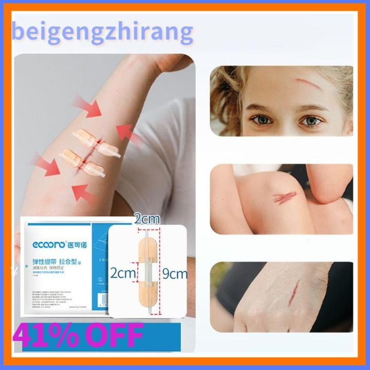 BEIGENGZHIRANG Wound Care Zip Sutures Bandaids Without Stitches ...