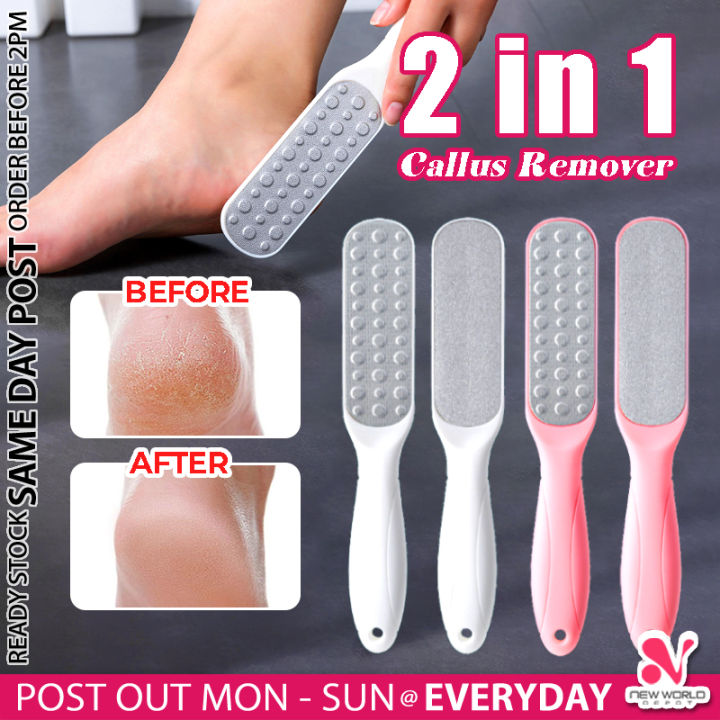𝗗𝗢𝗨𝗕𝗟𝗘 𝗦𝗜𝗗𝗘𝗗 》 Foot File Callus Remover Dead Skin Exfoliating Scrub ...