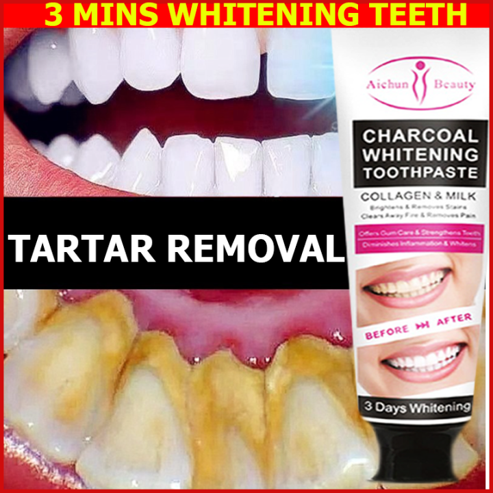 AICHUN Tooth whitening essence whitening teeth removes dental plaque ...