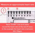 X CRAFT HOME Plastic EKG Calipers ECG/EKG Transparent Assessment Tool ...