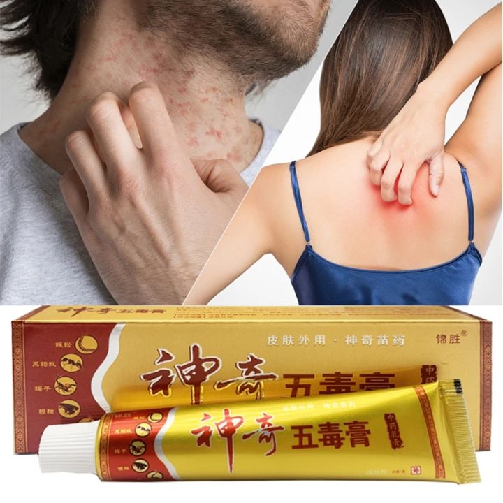 Improve Skin Health Eczema Psoriasis Cream Relieve Itching Effective