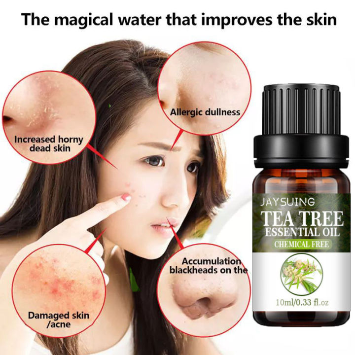 serum skin care pimple marks remover Facial Serum Acne Care ...