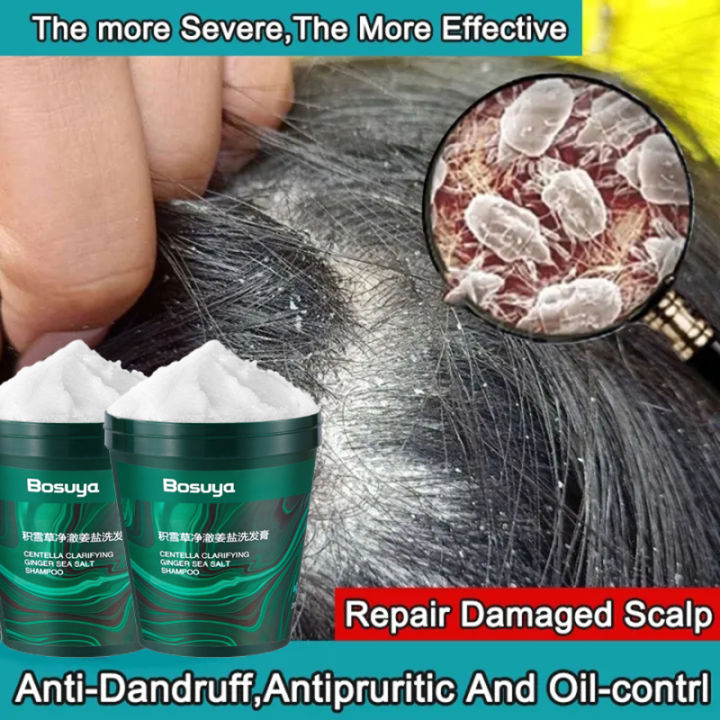 Sea salt anti dandruff shampoo 250g ---- effectively solves itchy scalp ...