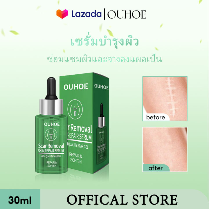 OUHOE รอยแผลเป็นถอด Skin Repair Serum Natural Face ครีม Moisturizer ...