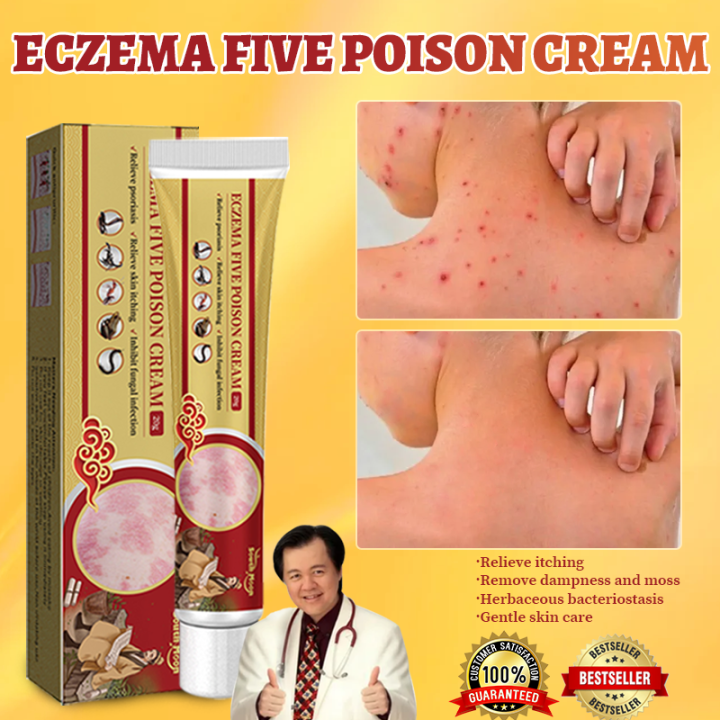 atoderma cream original bioderm ointment ointment for itchy skin and ...