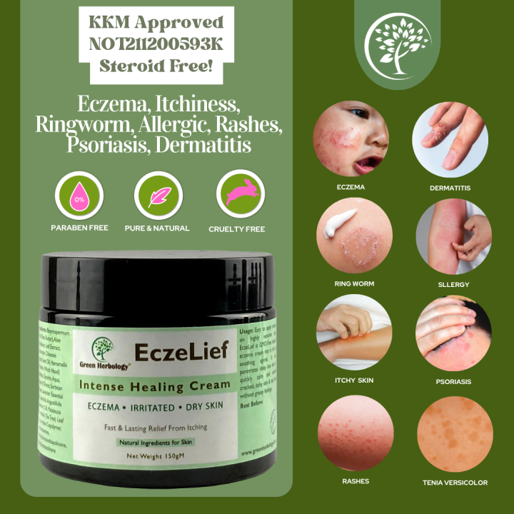 EczeLief – Natural Eczema Cream - Ekzema, Psoriasis, Itchy Skin - KKM ...