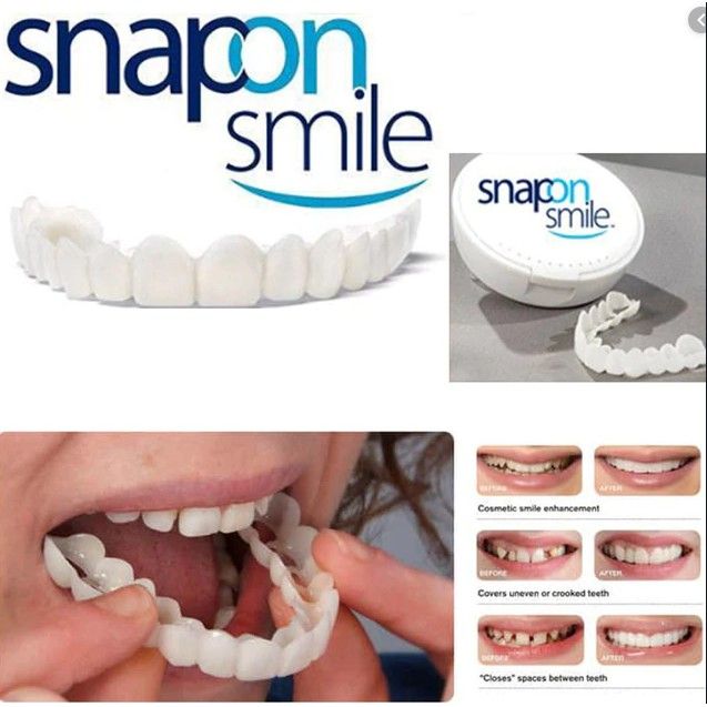 Original Snap On Smile Silicone Denture Care Instant Perfect Charming ...
