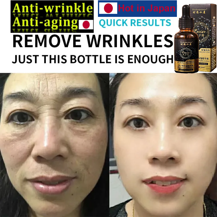 【Hot in Japan】Caviar Anti-wrinkle Essence anti aging serum dark spot ...