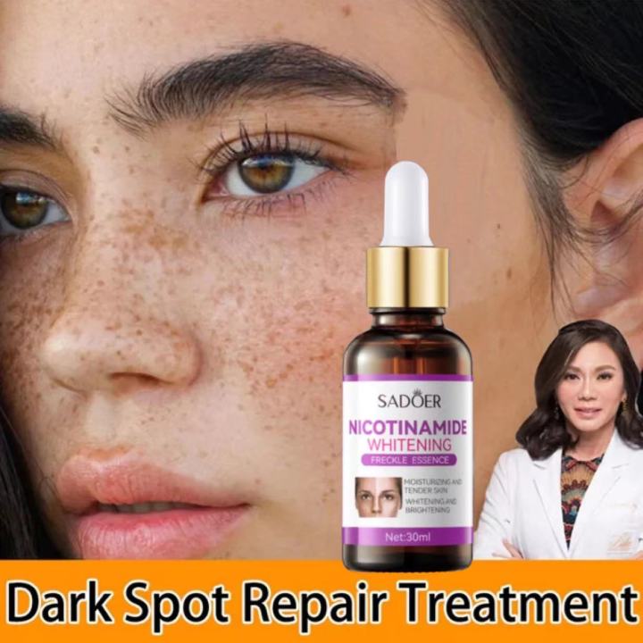 SADOER Whitening Essence Serum Remove Whiten Facial Moisturize Serum ...