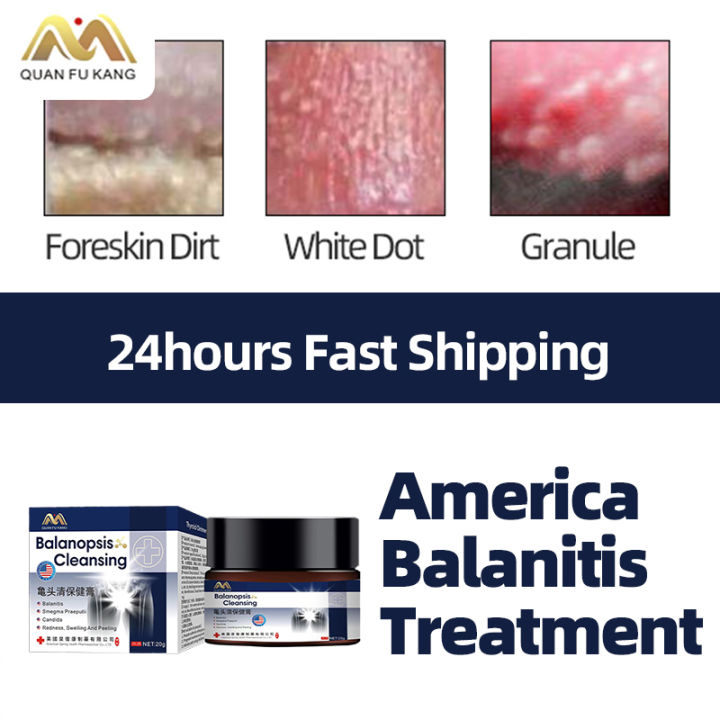 Free Shipping Balanitis Foreskin Treatment Cream Anti Infection Glans ...
