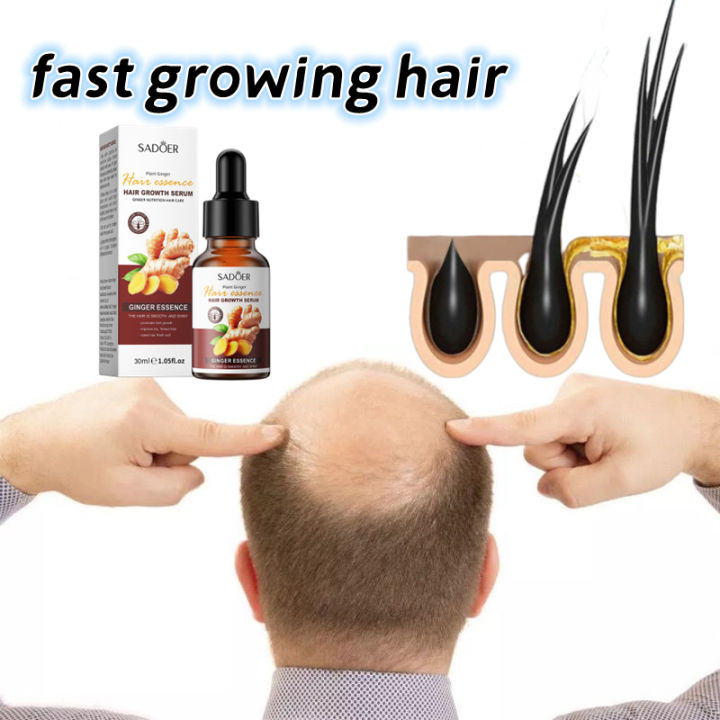Serum Hair Growth Essential Oil 20ml Original / Obat Hair Tonic ...