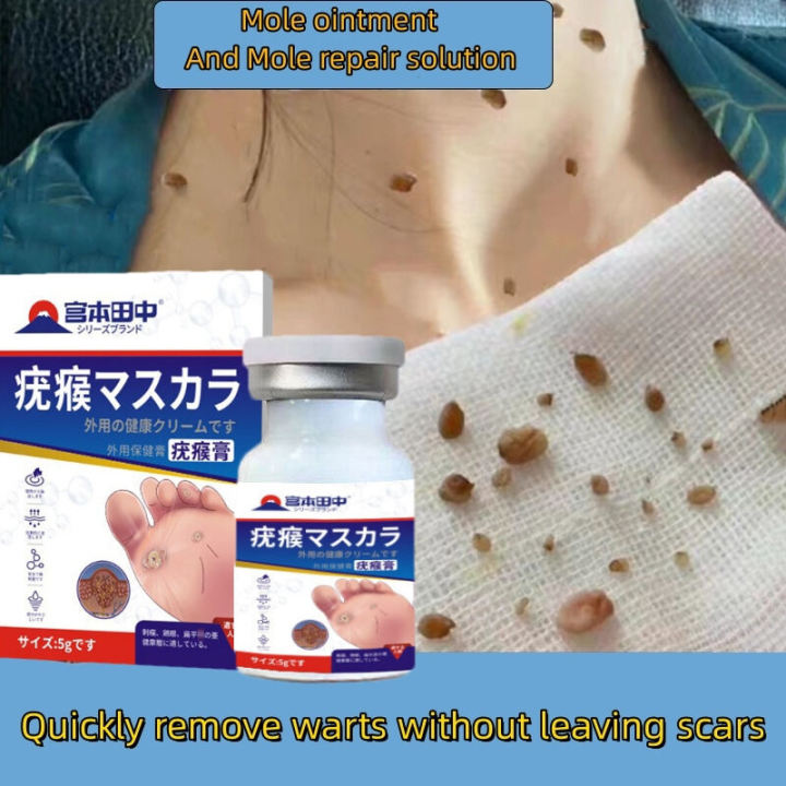 Wart You Skin Flat Liquid paste Wart Removing Nevus Paste without trace ...