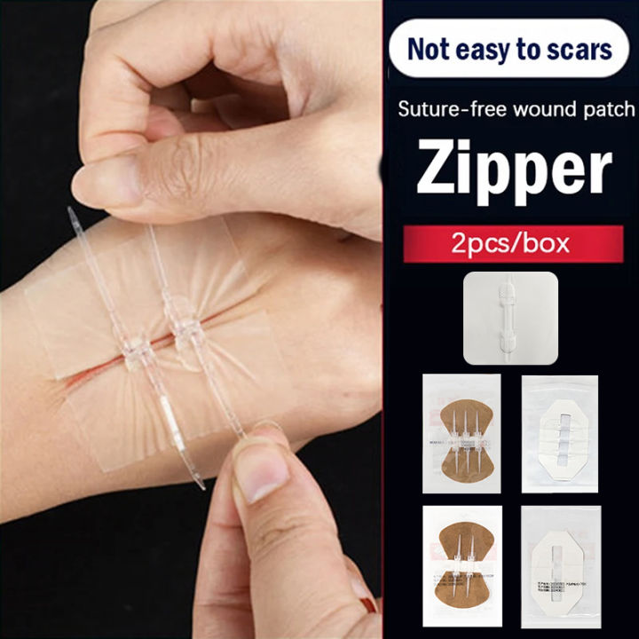 doushaopa Emergency Wound Closure Zip Stitch Sutures Bandaids Repair ...