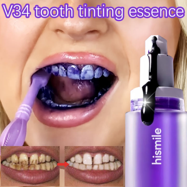 hismile v34 toothpaste colour corrector my smile ubat gigi teeth ...